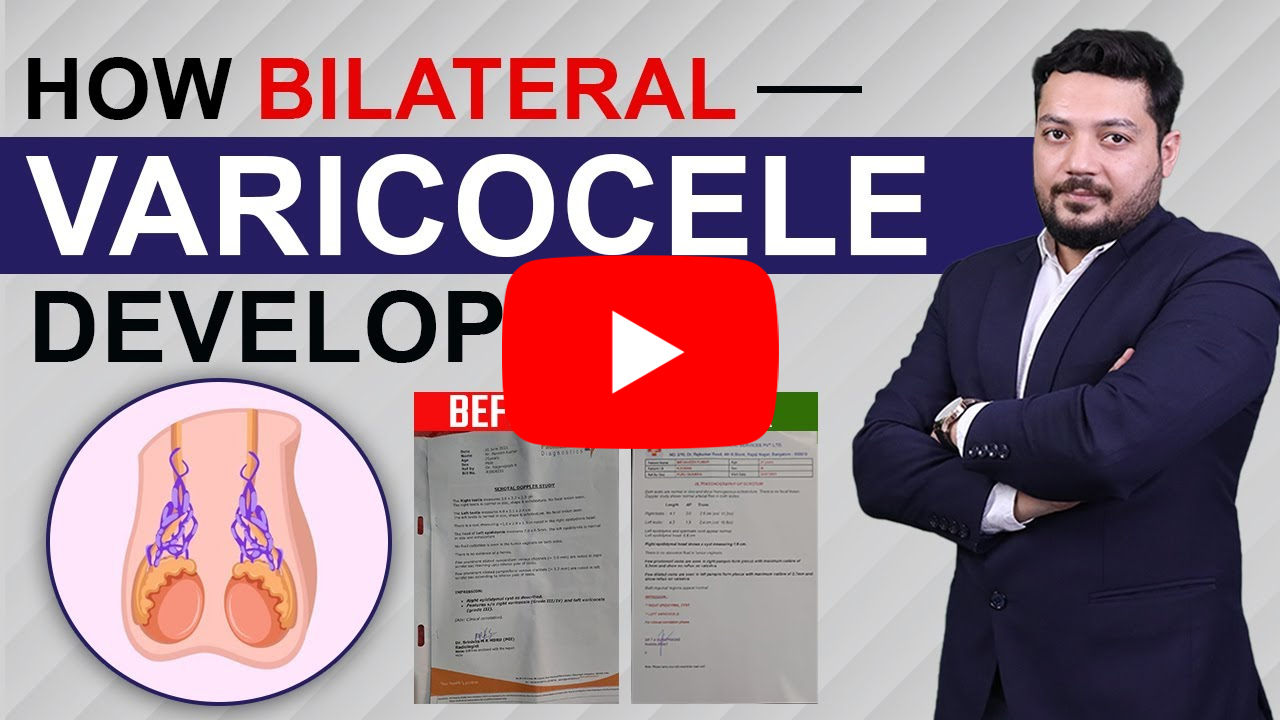 Varicocele Treatment without surgery - Dr. Health